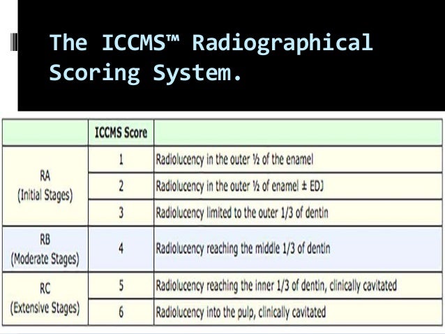 Icdas Caries Classification