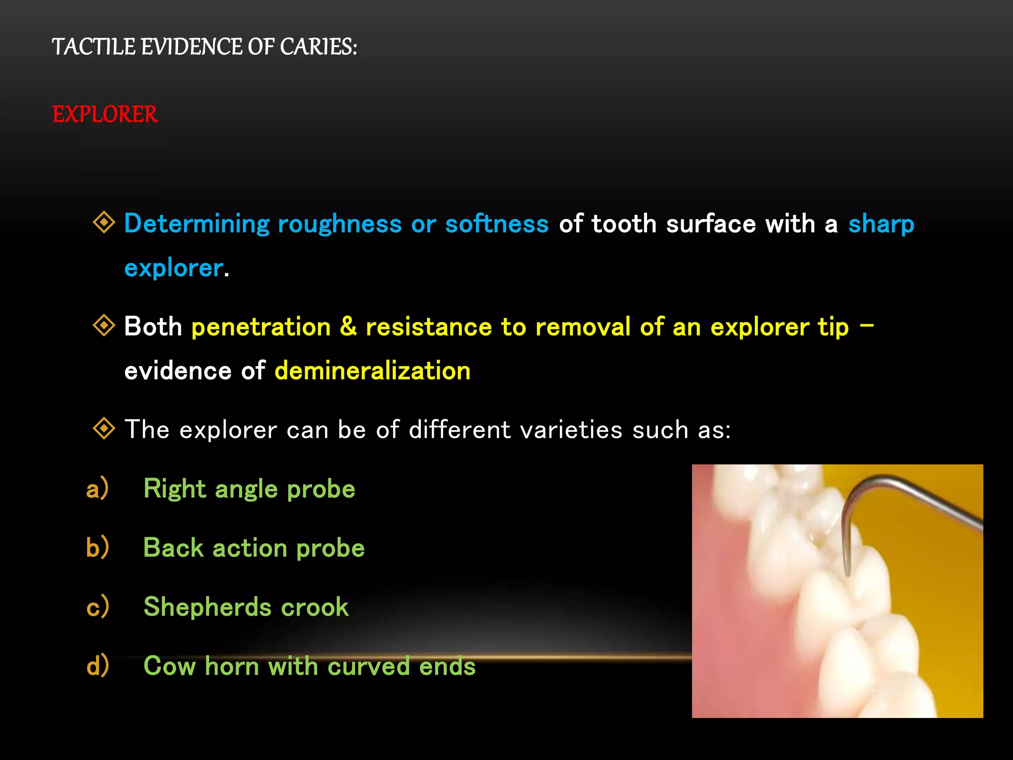 Caries diagnosis | PPTX