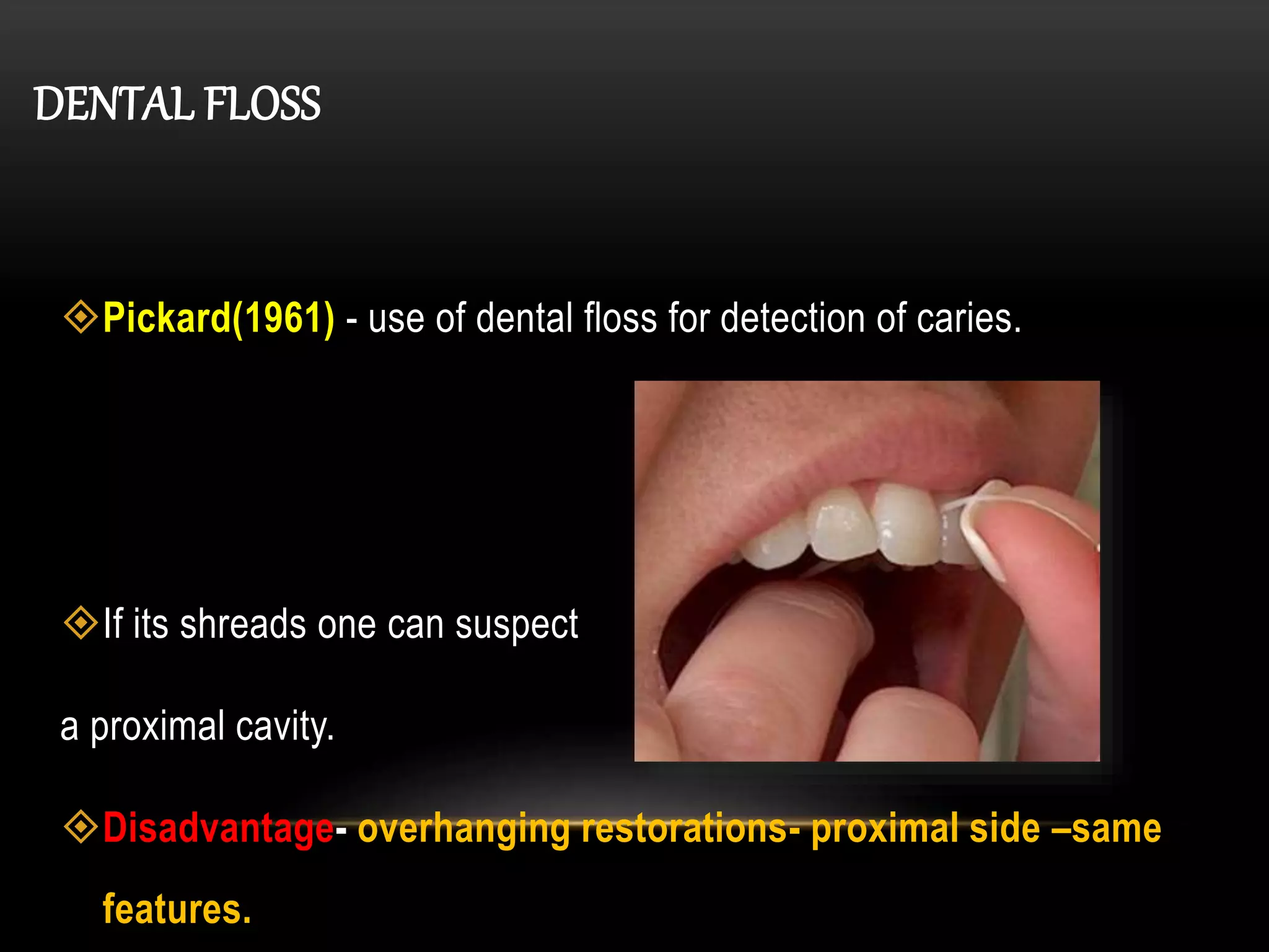 Caries diagnosis | PPTX