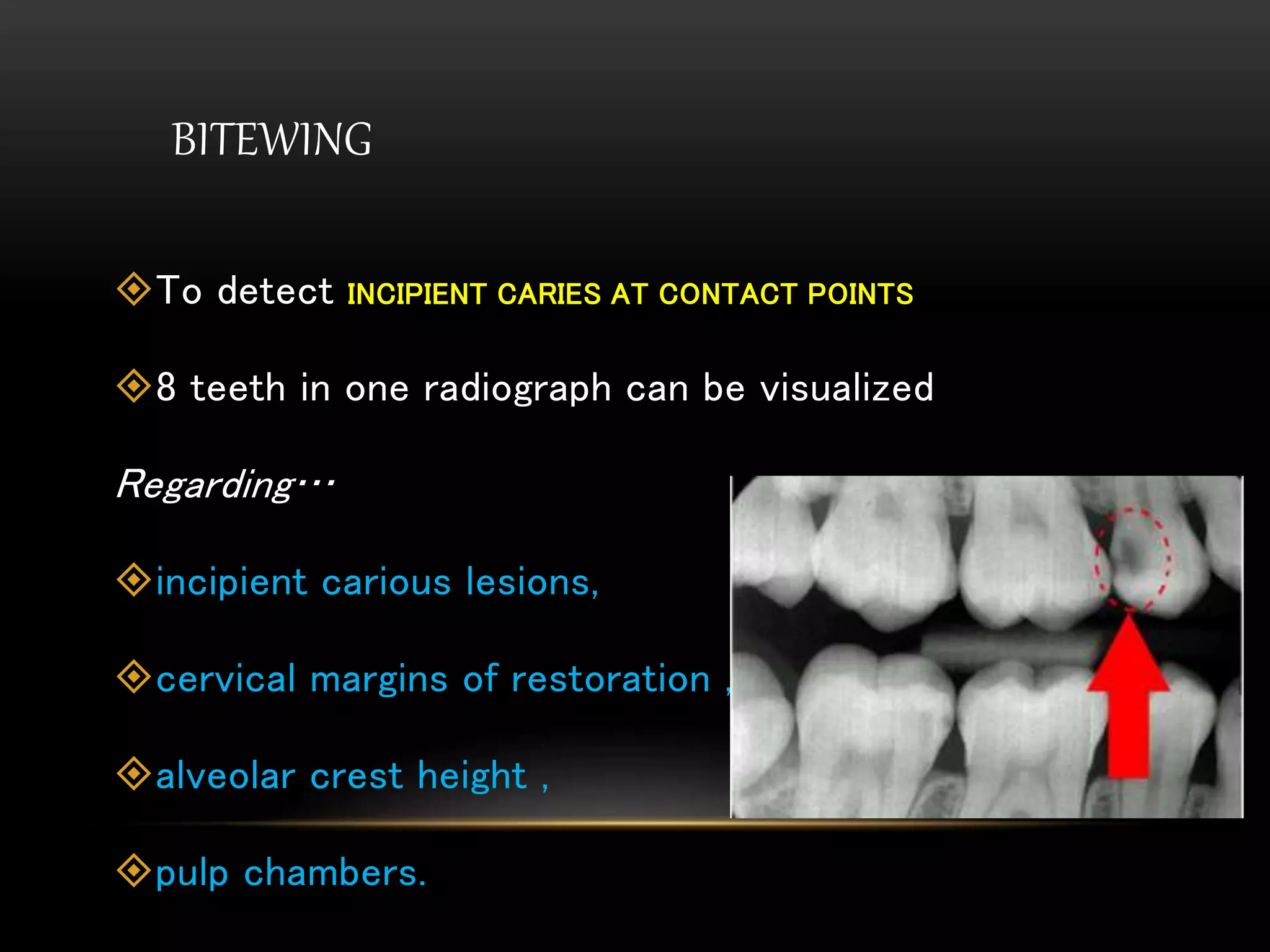 Caries diagnosis | PPTX