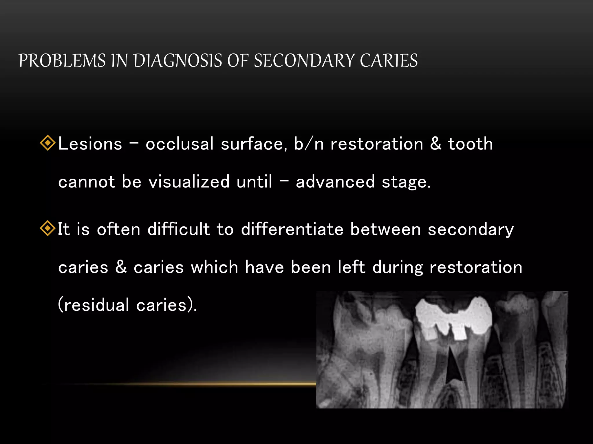 Caries diagnosis | PPTX