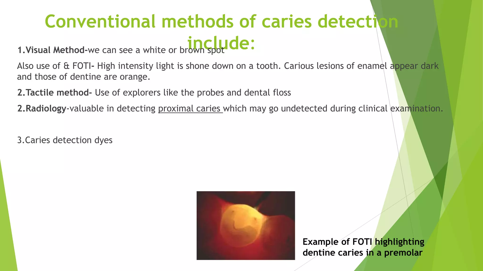 Caries diagnosis | PPTX