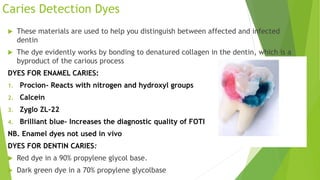 Caries diagnosis | PPTX