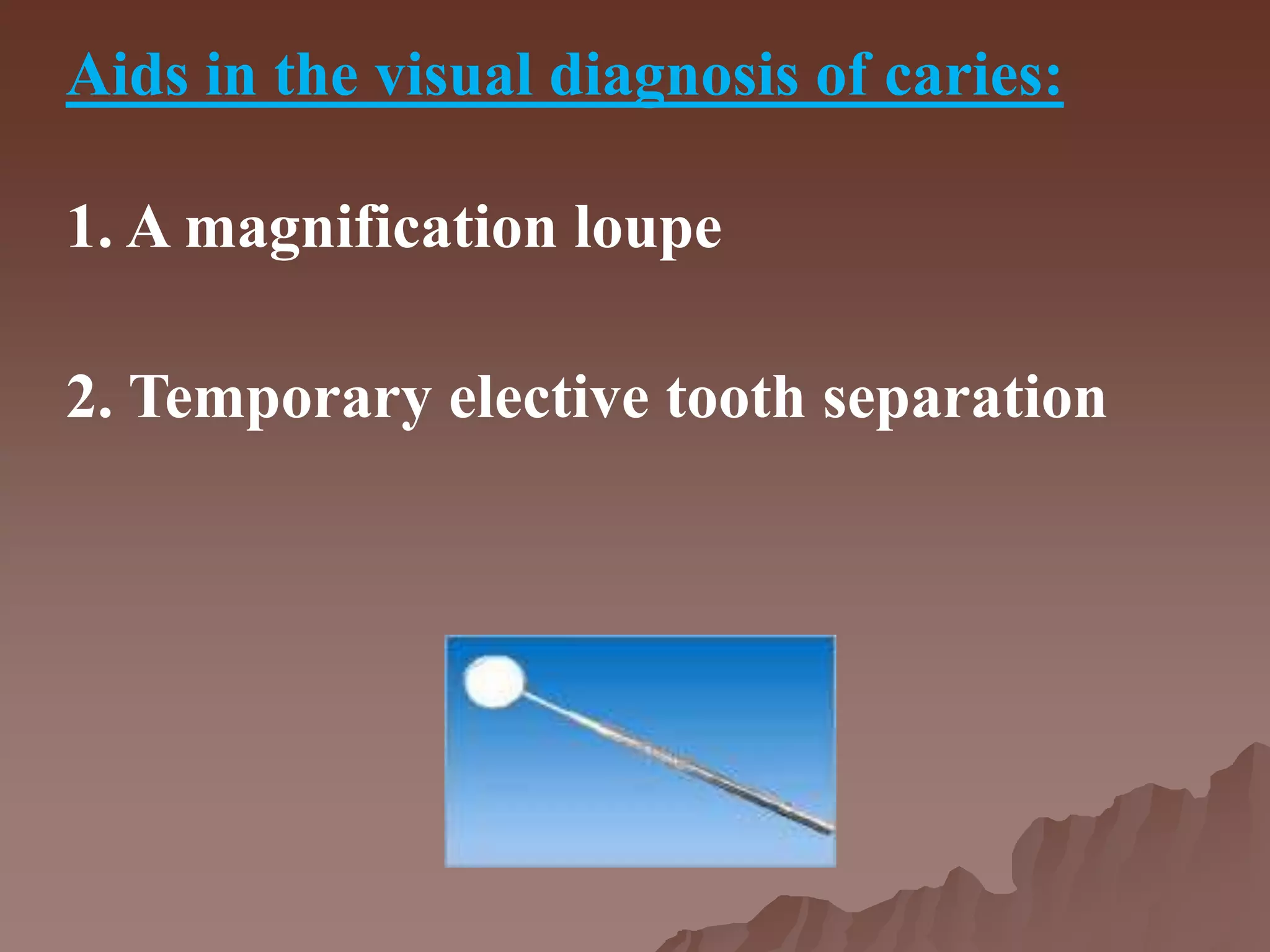 Caries diagnosis | PPT