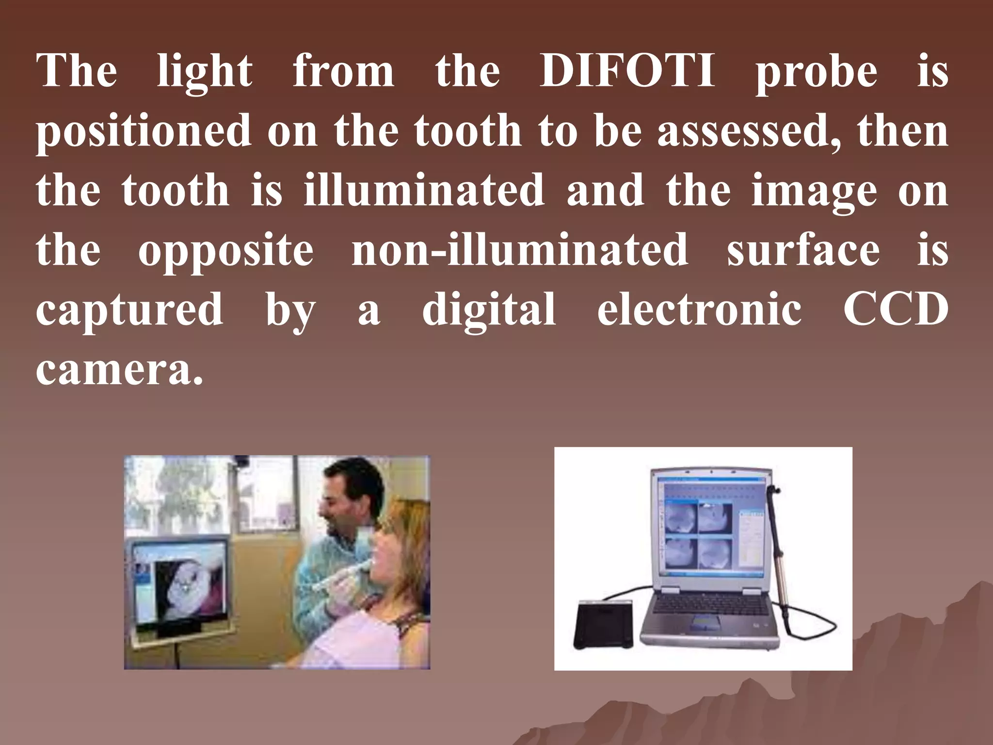 Caries diagnosis | PPT