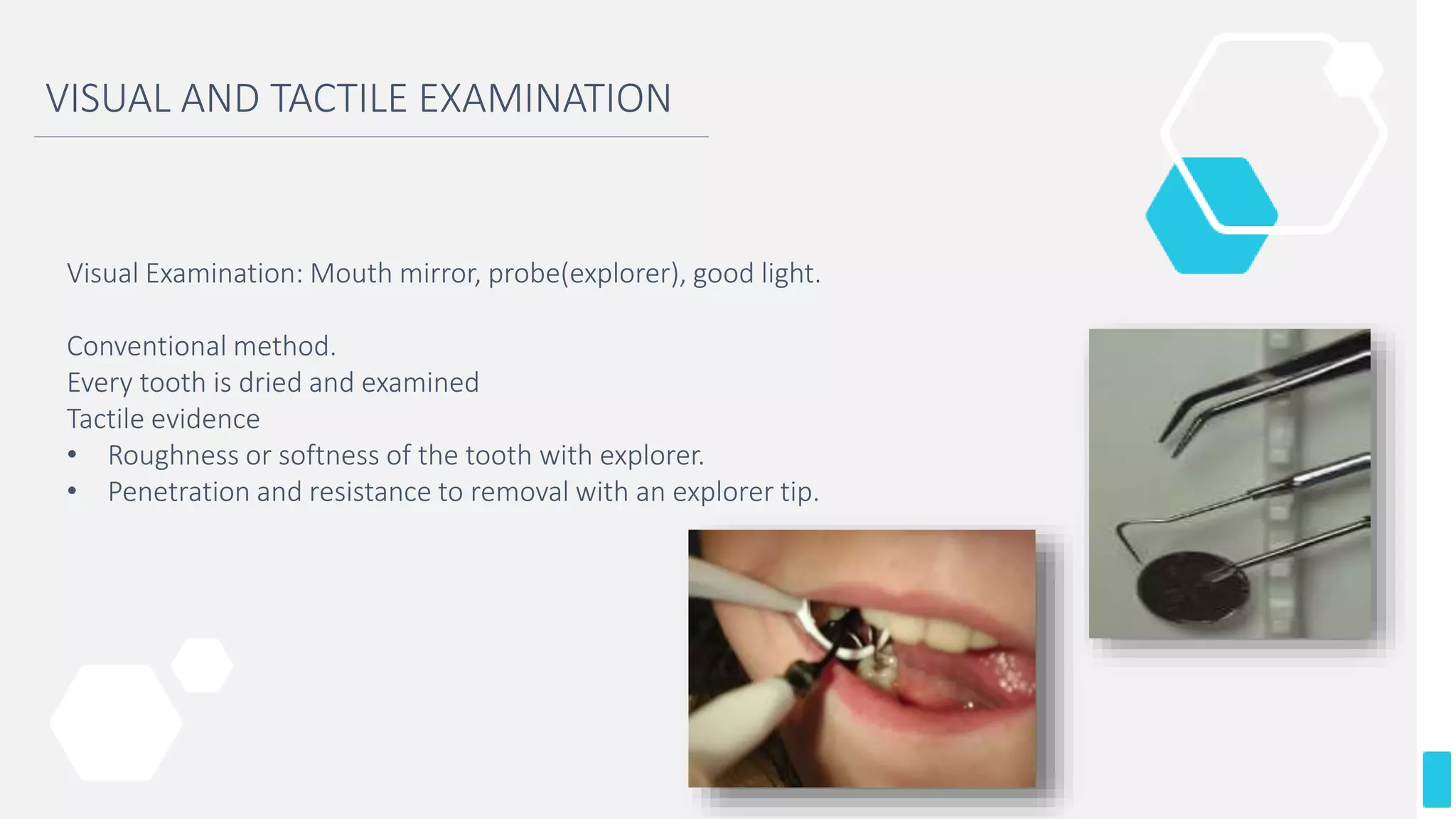 Caries diagnosis : NEW TRENDS | PPTX