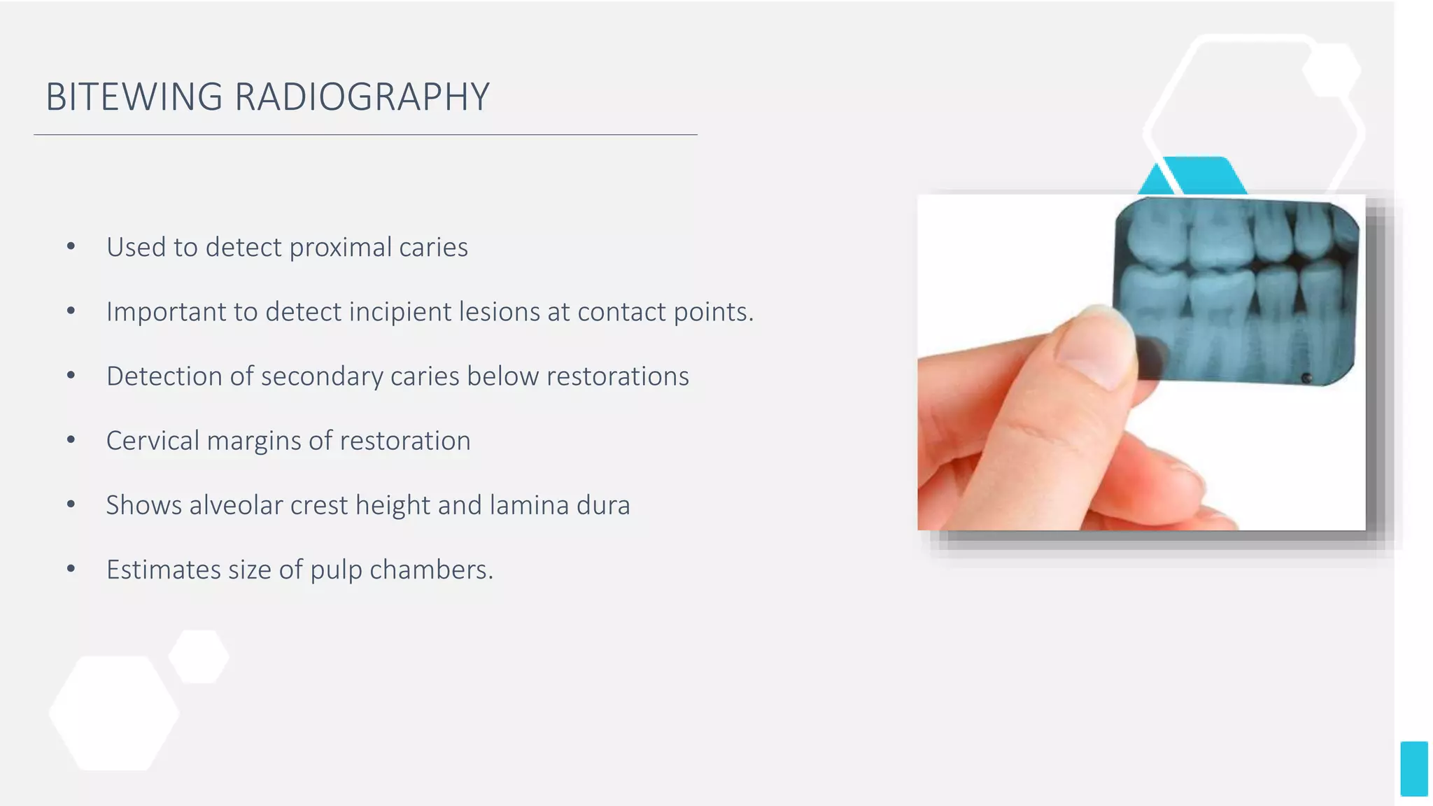 Caries diagnosis : NEW TRENDS | PPTX