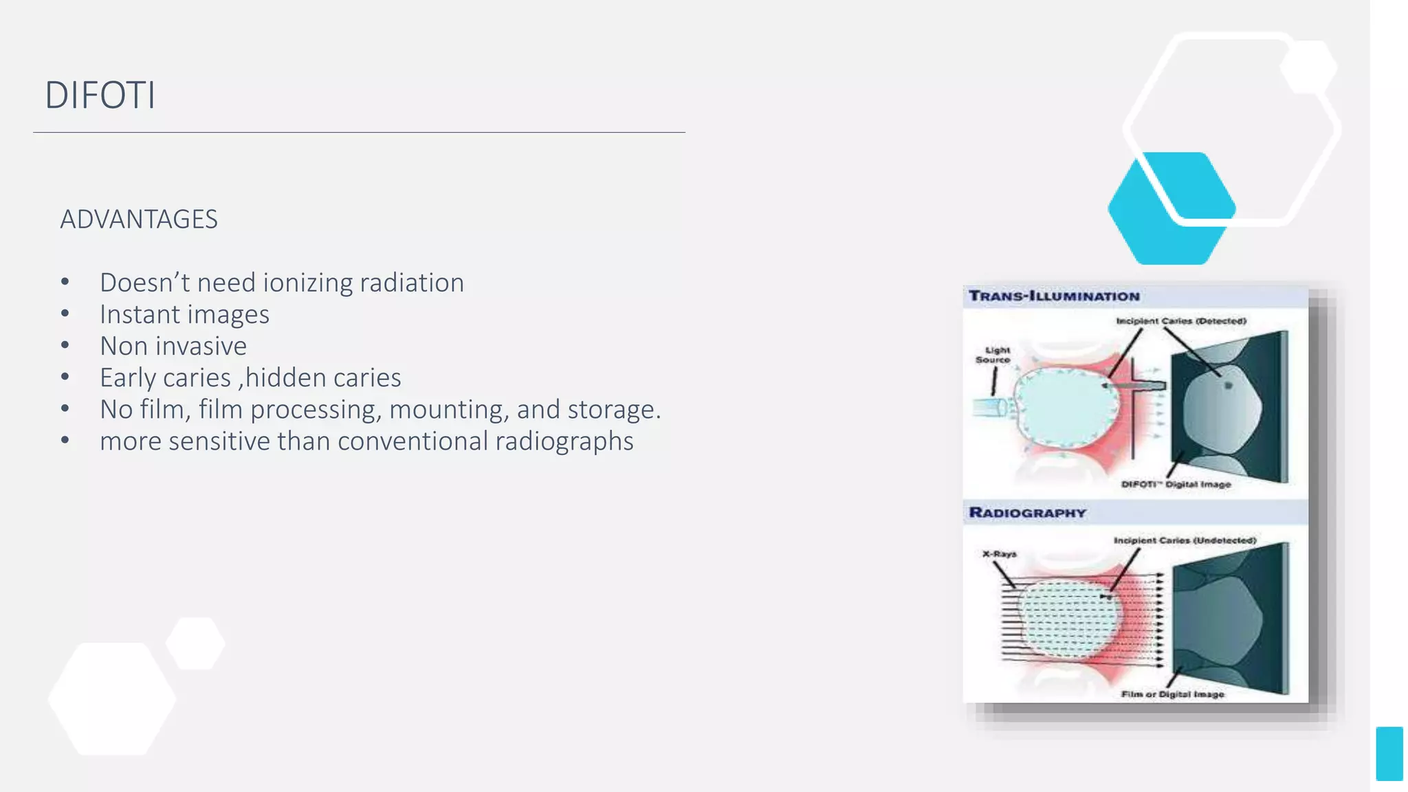 Caries diagnosis : NEW TRENDS | PPTX