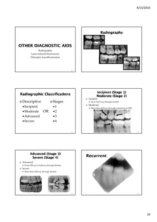 Caries diagnosis handout | PDF