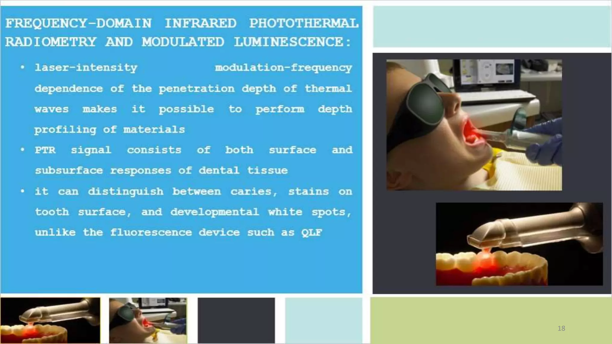 Caries diagnostic methods | PPTX