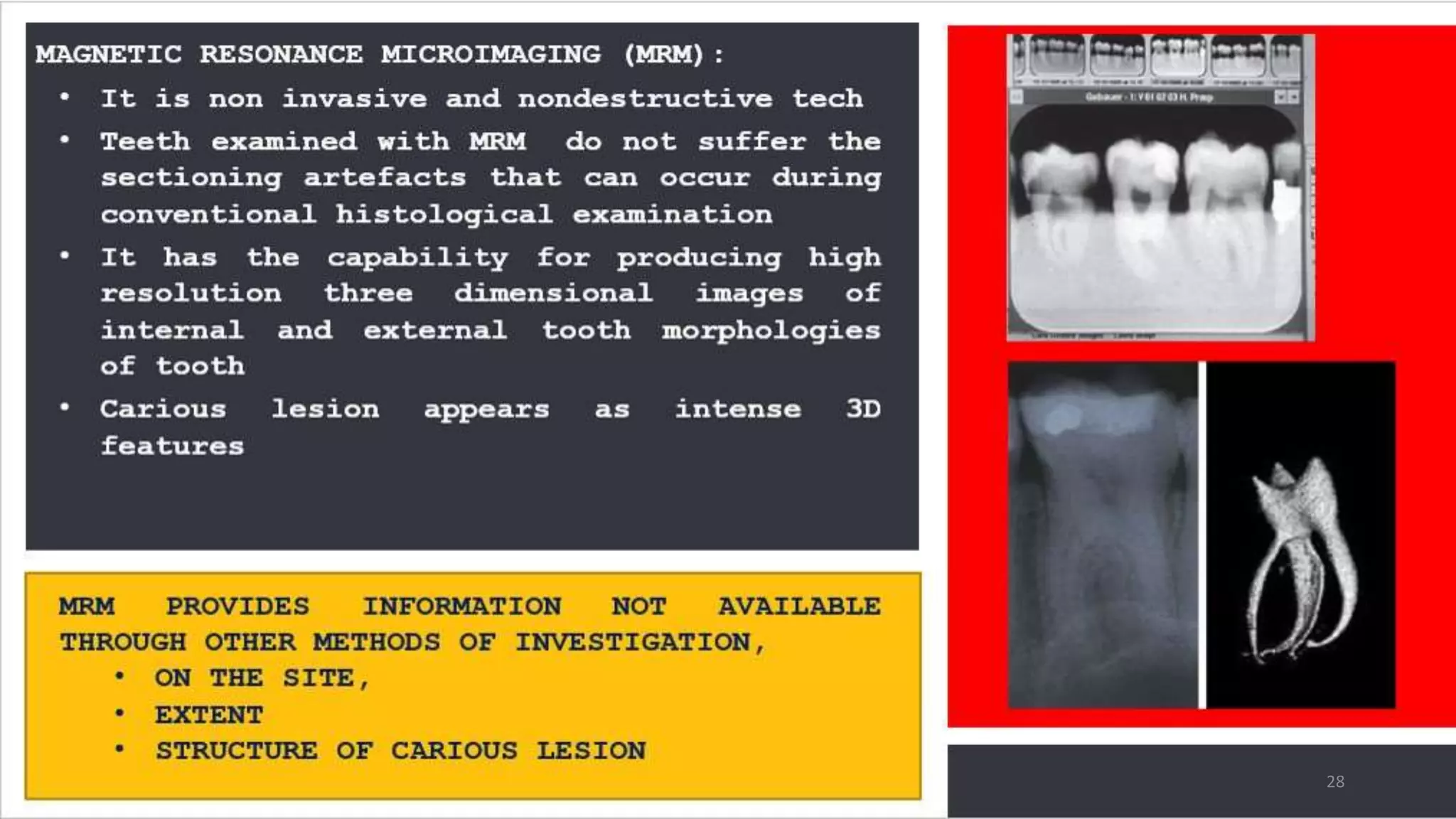 Caries diagnostic methods | PPTX