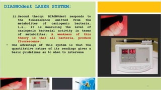 Caries diagnostic methods | PPT