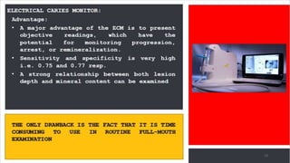 Caries diagnostic methods | PPT