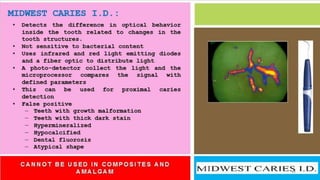 Caries diagnostic methods | PPT