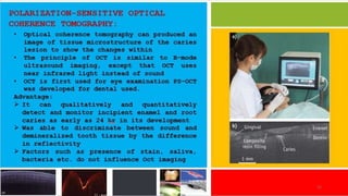 Caries diagnostic methods | PPT