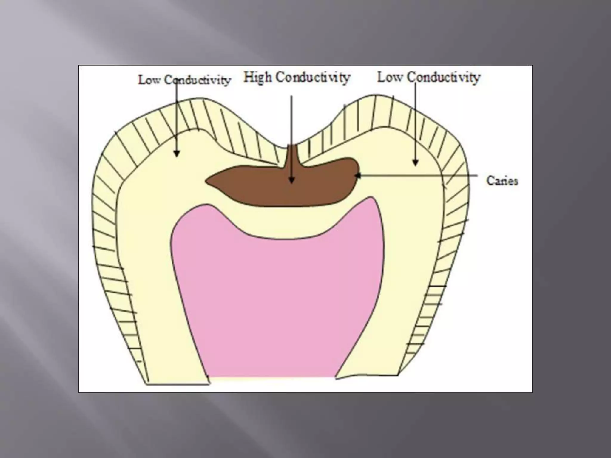 Caries in children and adolescents | PPTX