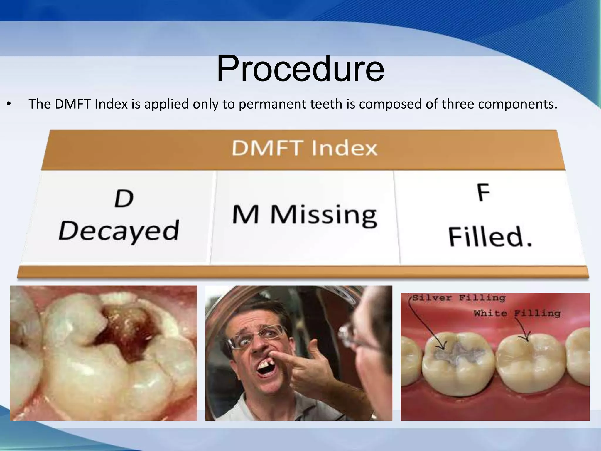 Caries indices | PPTX