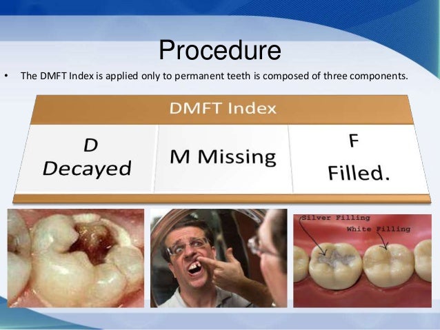 Caries indices