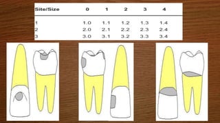 Caries management strategies in primary molars | PPTX