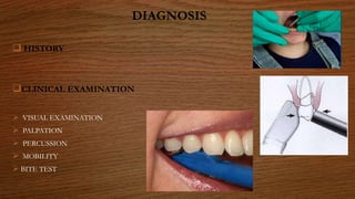 Caries management strategies in primary molars | PPTX