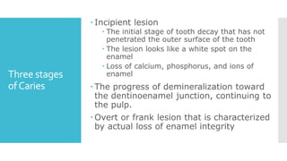Dental Caries | PPT