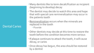 Dental Caries | PPT