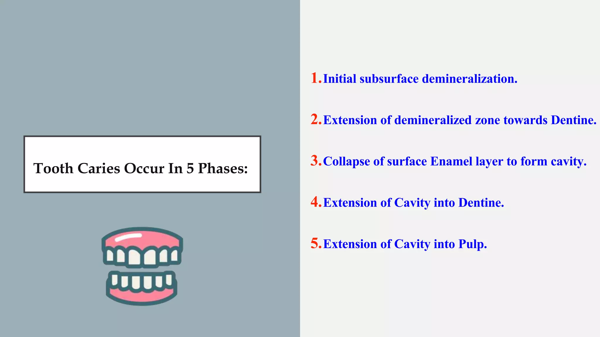 Caries Progression | PPSX