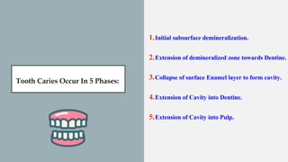 Caries Progression | PPSX