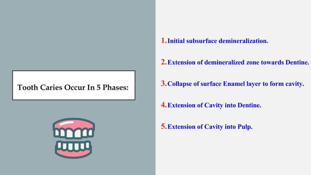 Caries Progression | PPSX | Dental Health | Diseases and Conditions