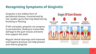 Caries, Pulpitis, Apical Periodontitis, Periodontal Diseases Or ...