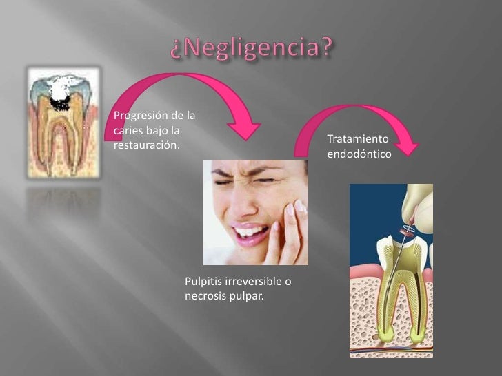 Caries residual