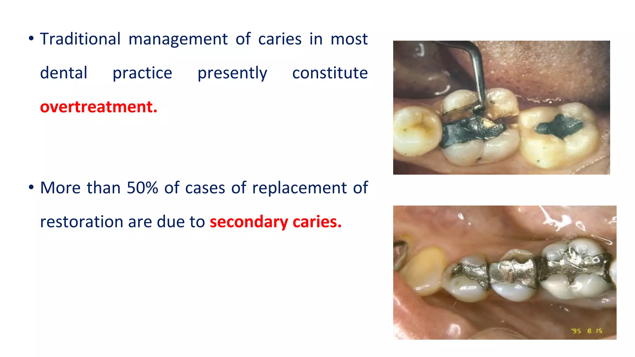 Caries risk assessment | PPT