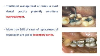 Caries risk assessment | PPT