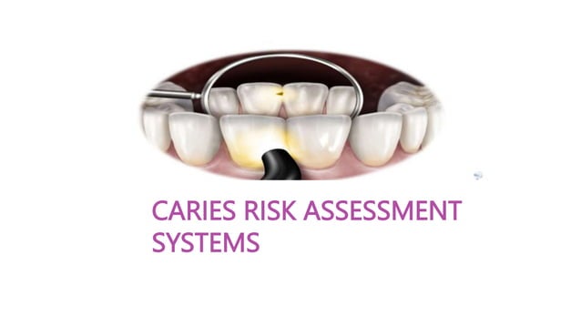 Caries risk assessment in detail description | PPTX