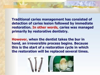 Caries treatment | PPT