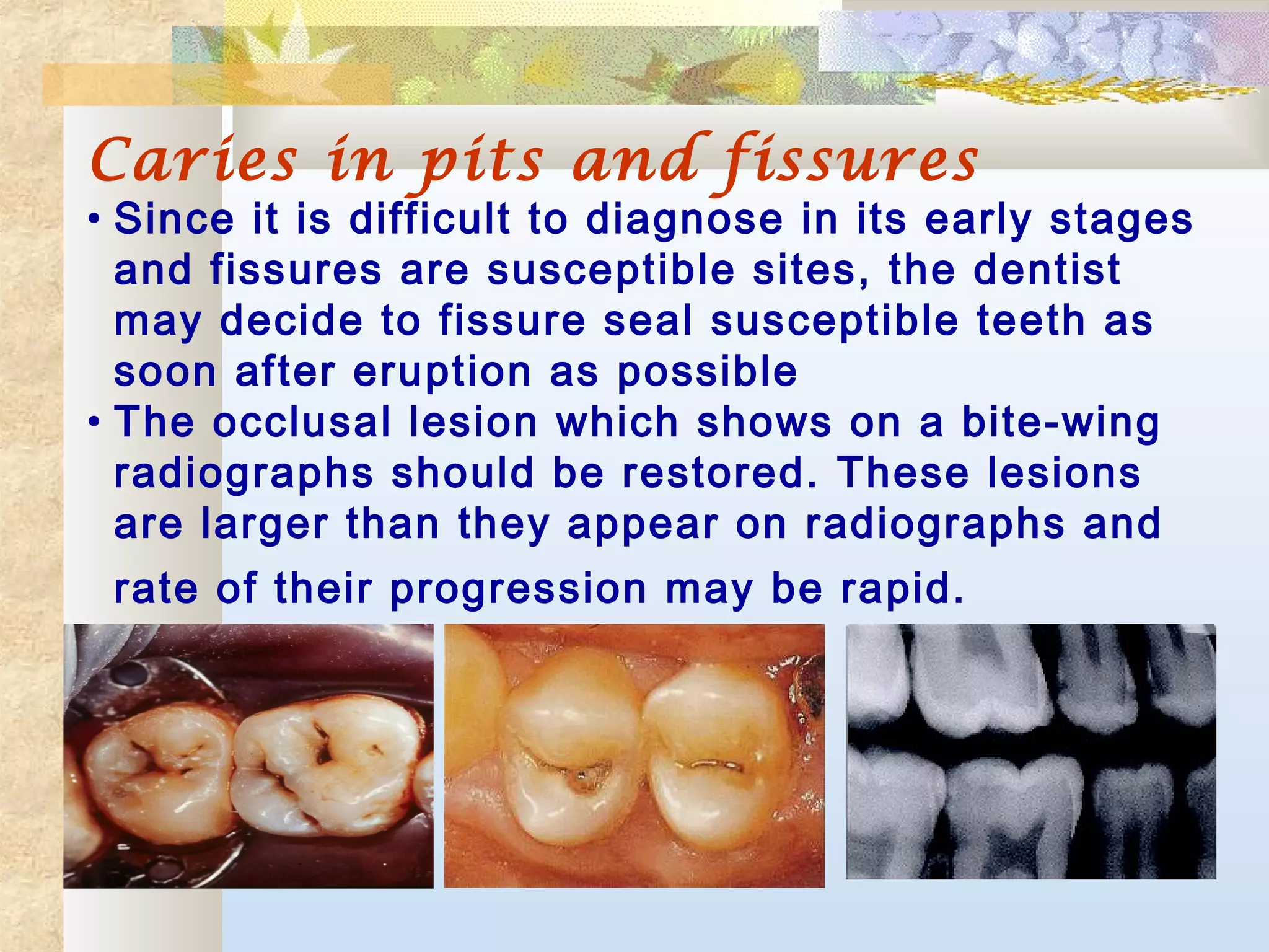 Caries Treatment | PPT