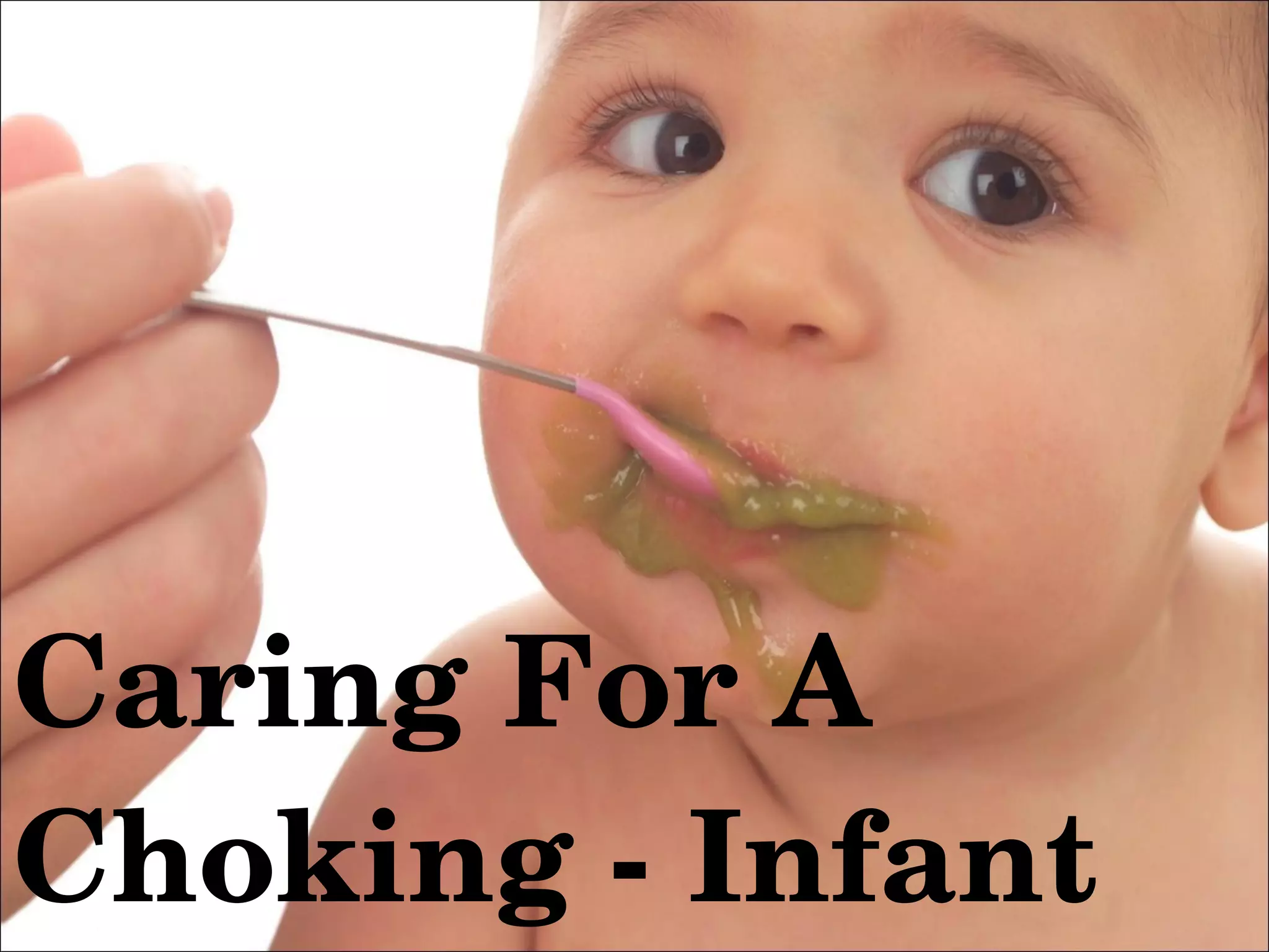 Caring For A Conscious Choking Infant | PPT