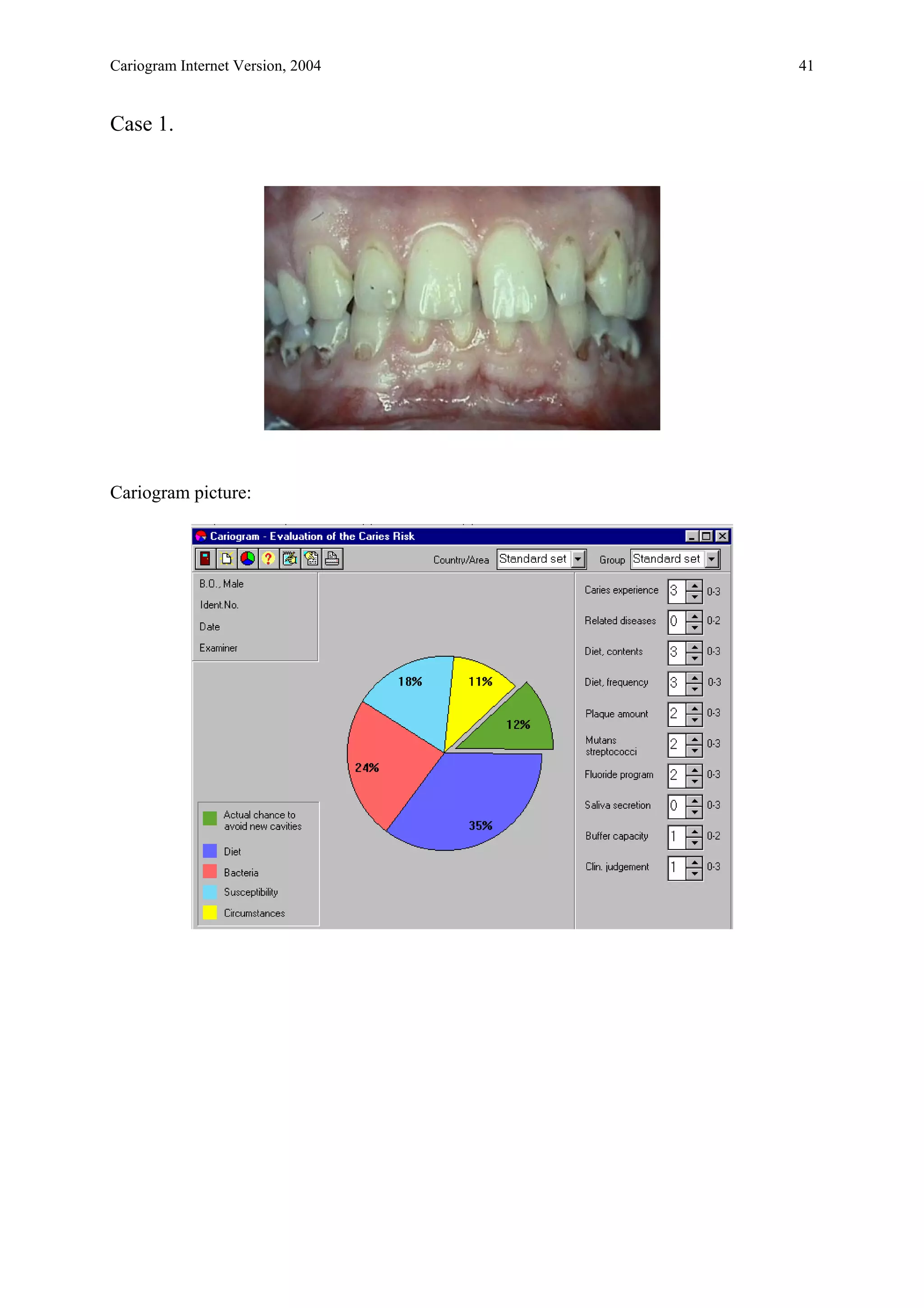 Cariogram manual 201net | PDF