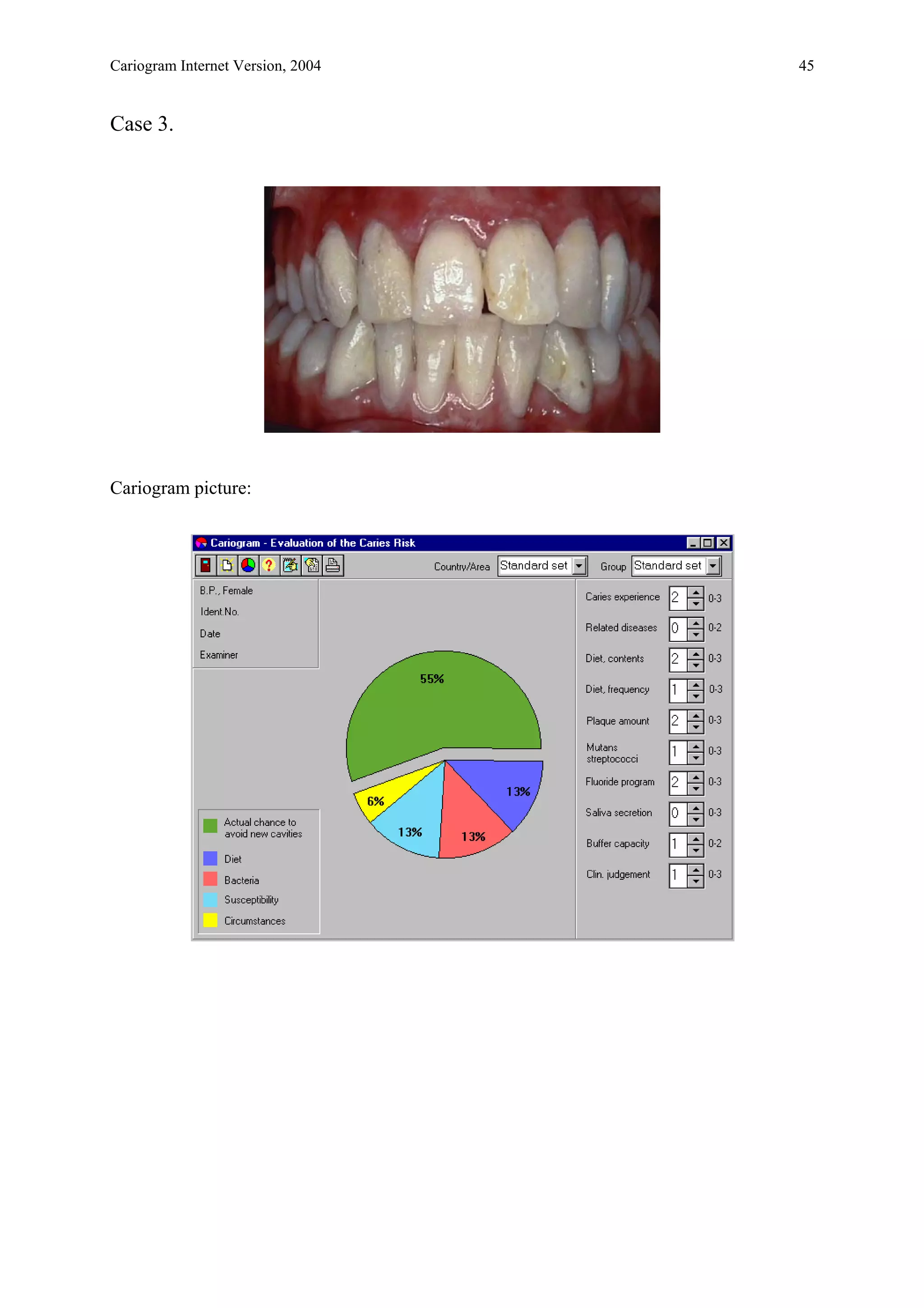 Cariogram manual 201net | PDF