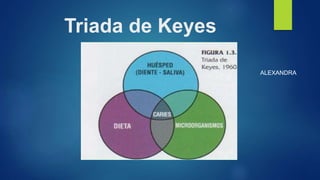 Conceptos actuales de la etiología de las caries | PPTX
