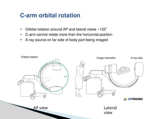 C-arm basis principle for the beginners and everyone | PPTX