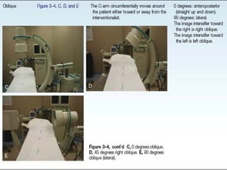 C-arm basis principle for the beginners and everyone | PPTX