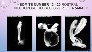 Carnegie stages | PPTX