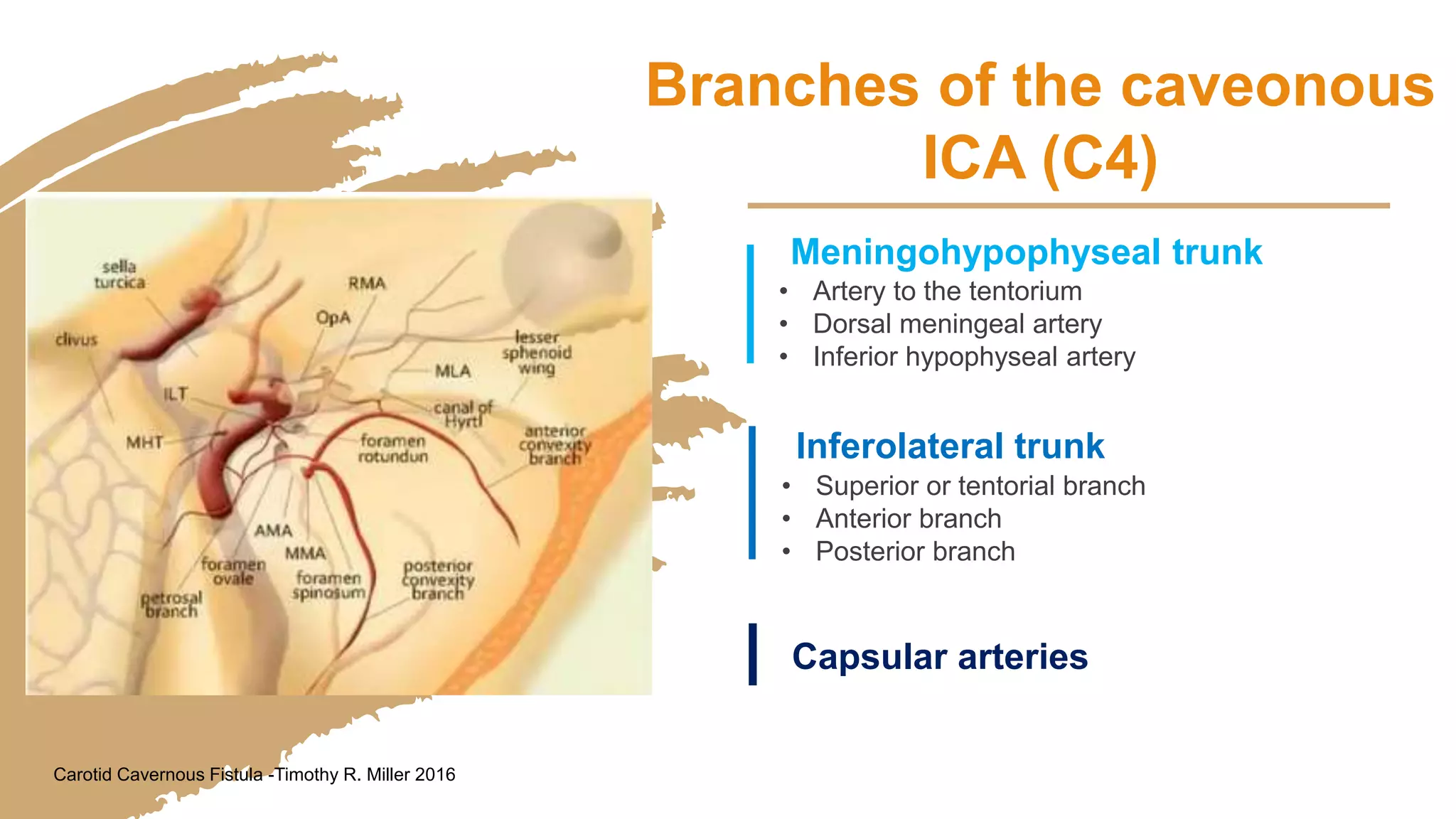 Caroticocavernous fistula HAKU | PPTX