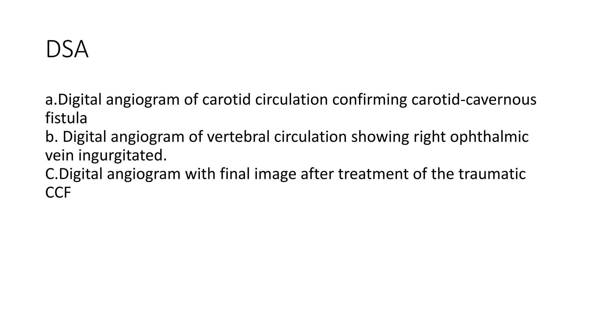 Carotico-cavernous fistula Presentation. | PPTX