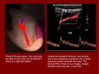 Carotid | PDF | Heart and Cardiovascular Diseases | Diseases and Conditions