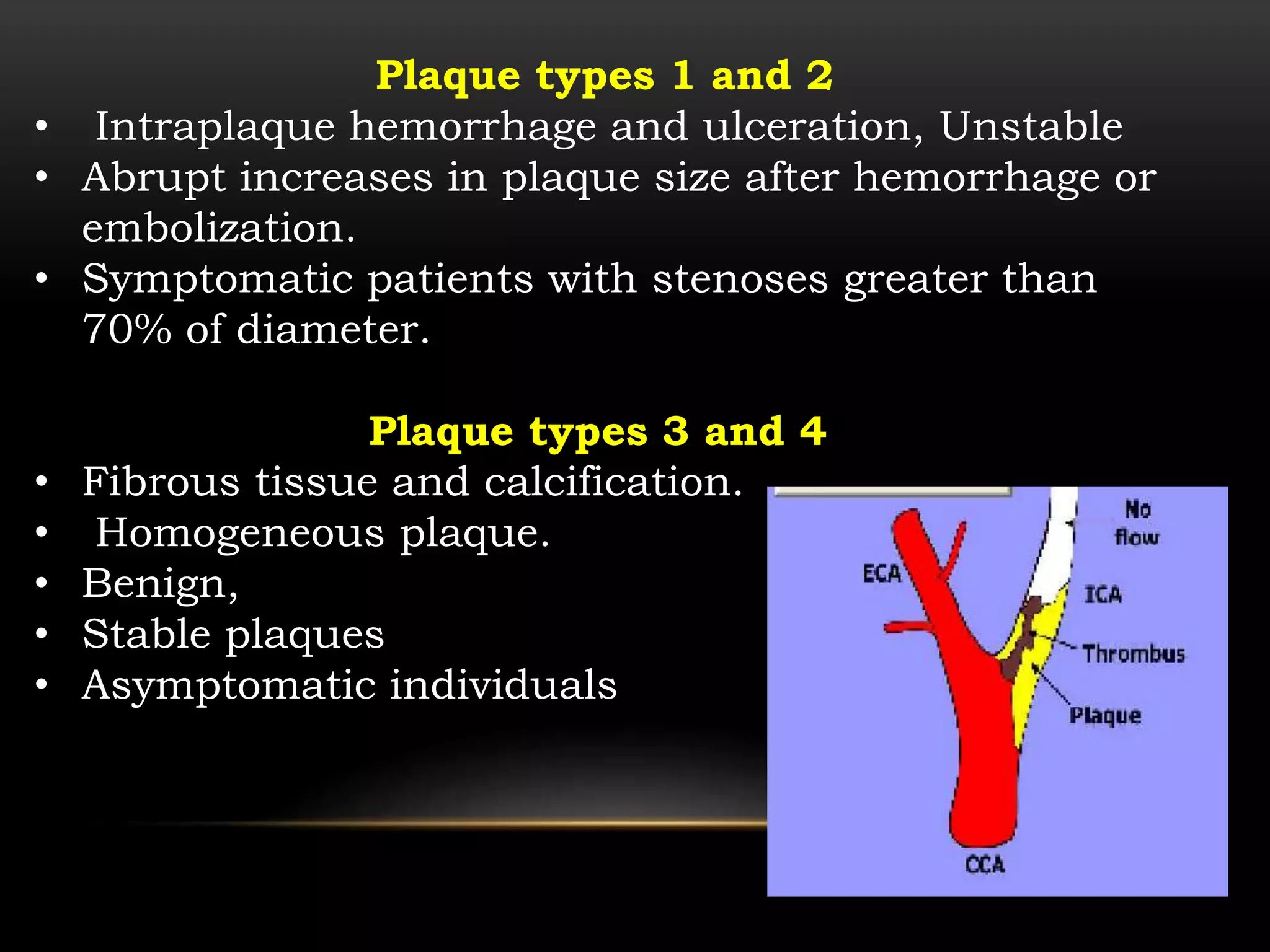 CAROTID DOPPLER STUDY | PPTX