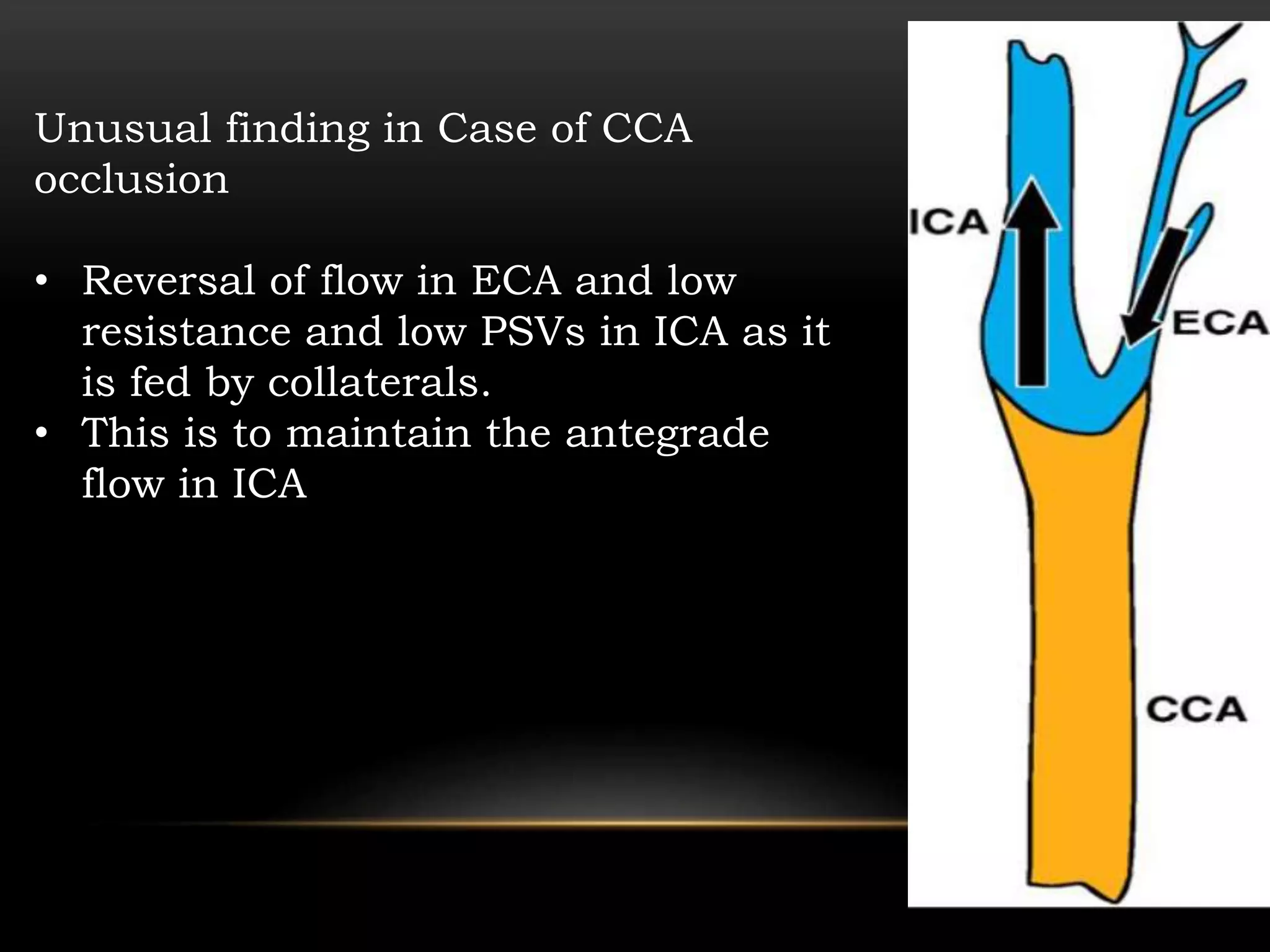 CAROTID DOPPLER STUDY | PPTX