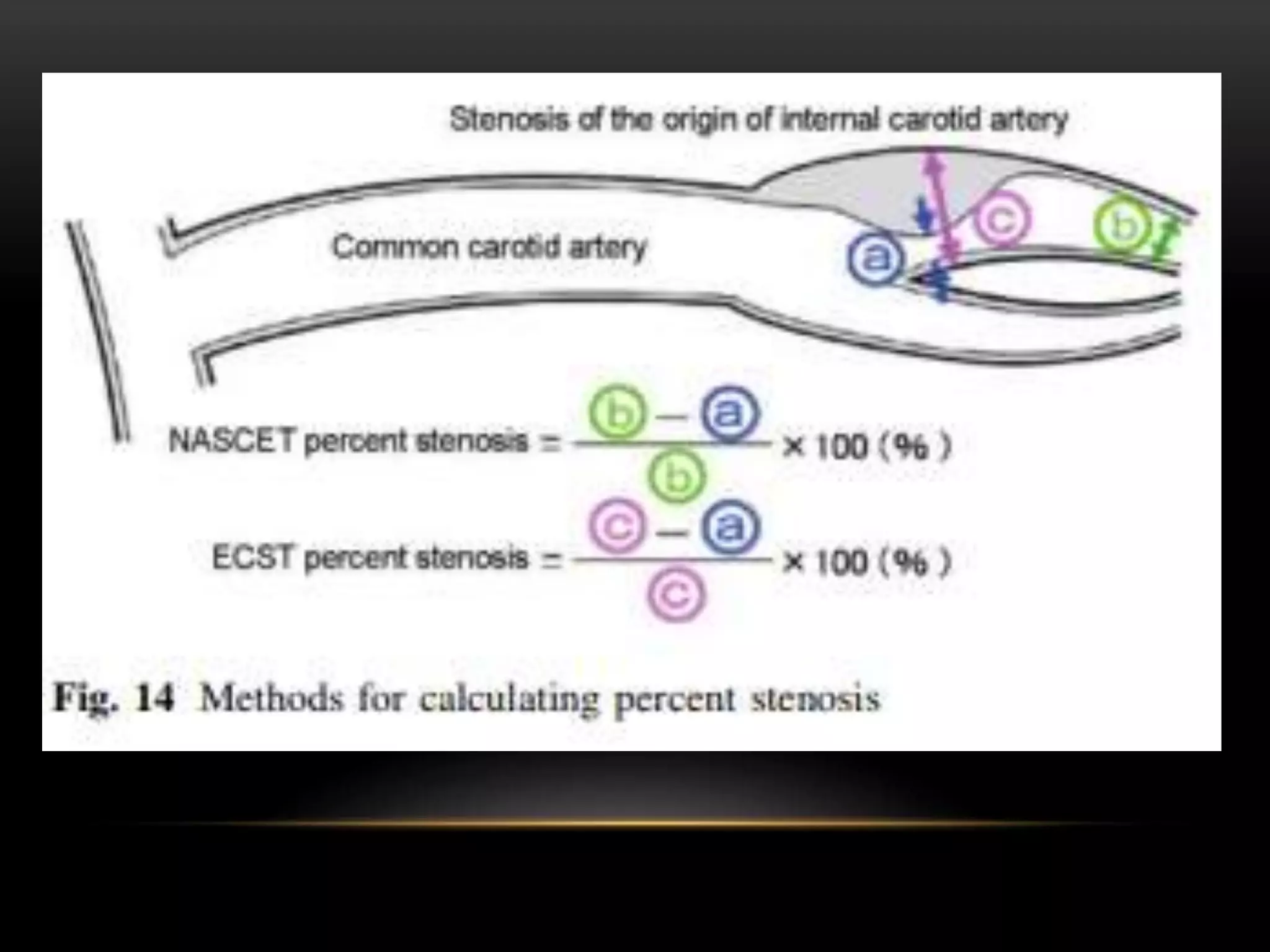 CAROTID DOPPLER STUDY | PPTX