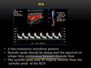 CAROTID DOPPLER STUDY | PPTX
